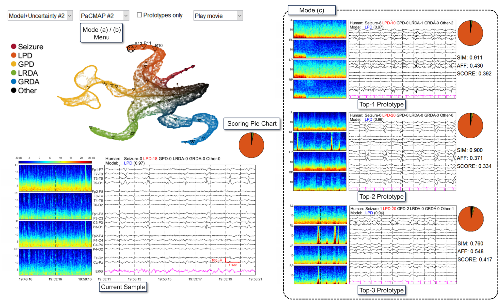 AI Helps Medical Professionals Read Confusing EEGs to Save Lives | Duke ...